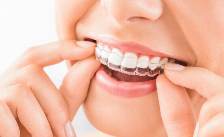 Does Invisalign Hurt? 7 Effective Tips