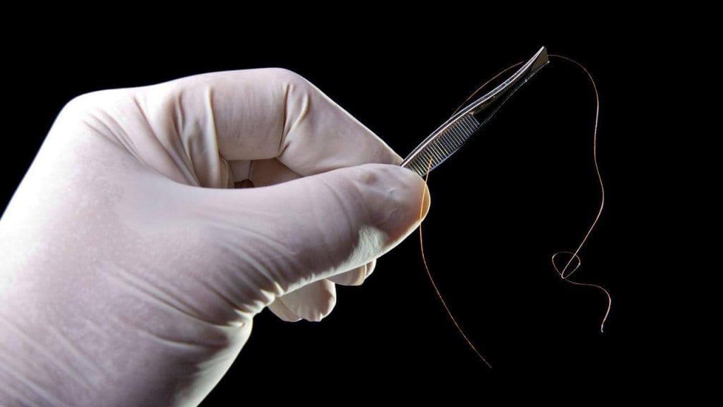All You Need to Know to Clear a Hair Follicle Drug Test